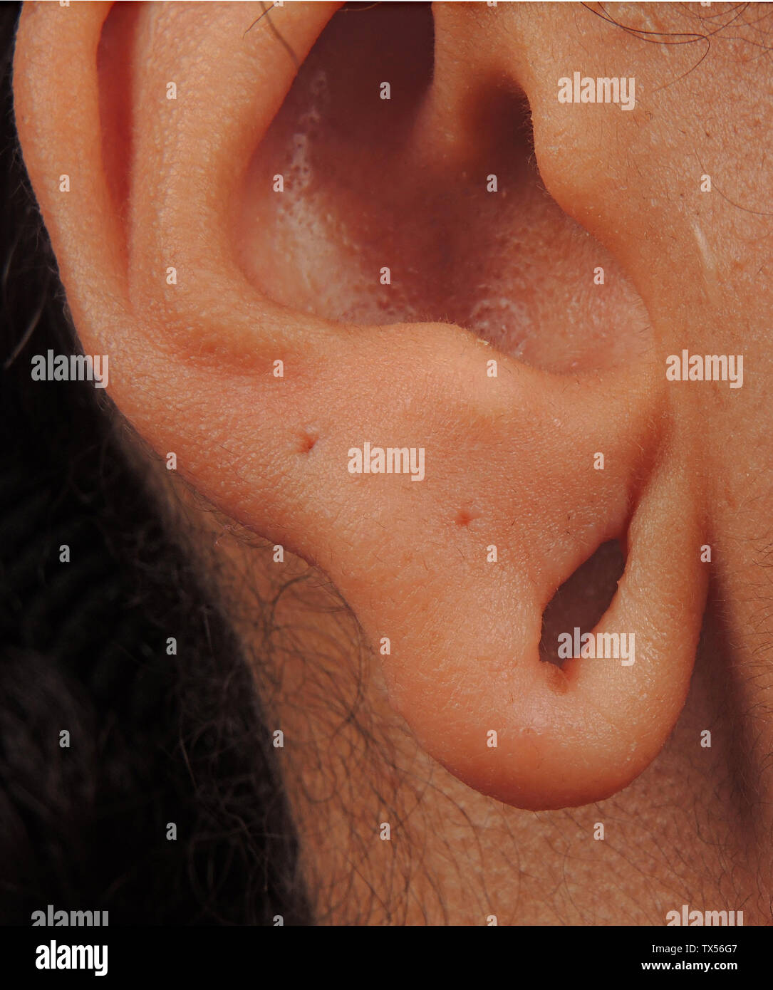 Loreille hi-res stock photography and images - Alamy