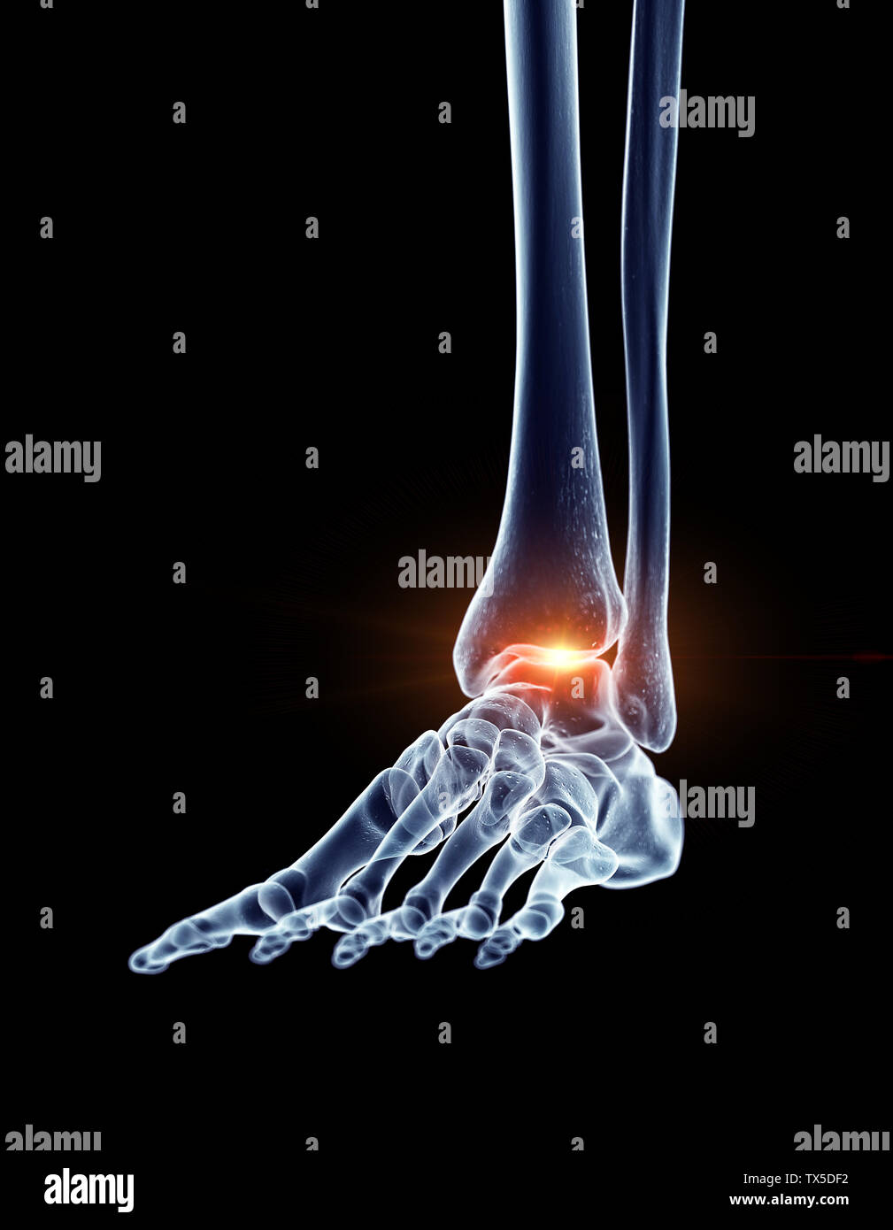 Transparent arthritis hi-res stock photography and images - Alamy