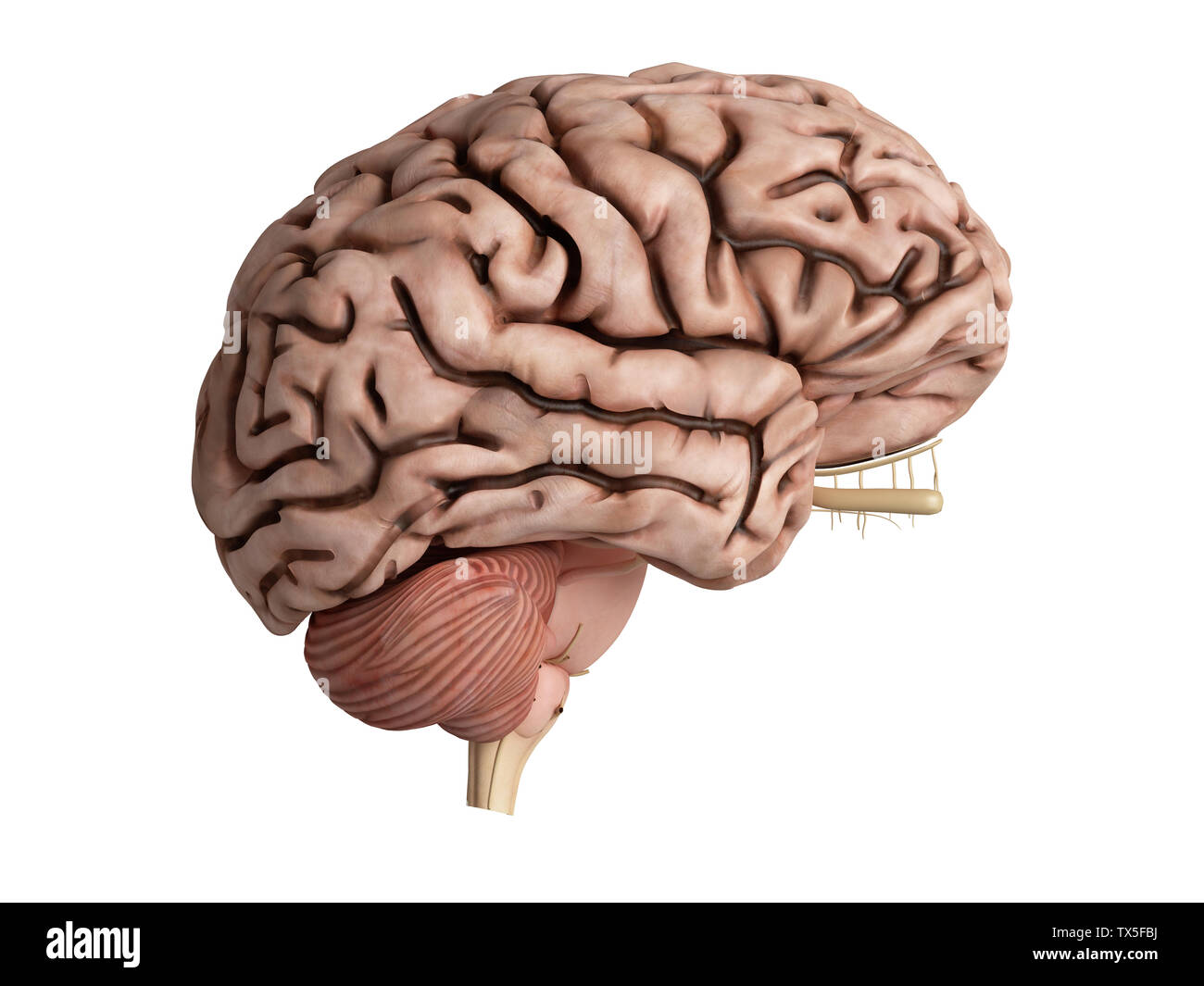 3d rendered, medically accurate illustration of an unhealthy brain ...