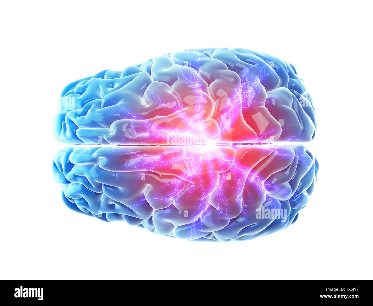 Inflamed brain hi-res stock photography and images - Alamy