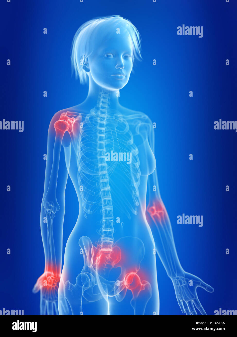 Transparent arthritis hi-res stock photography and images - Alamy