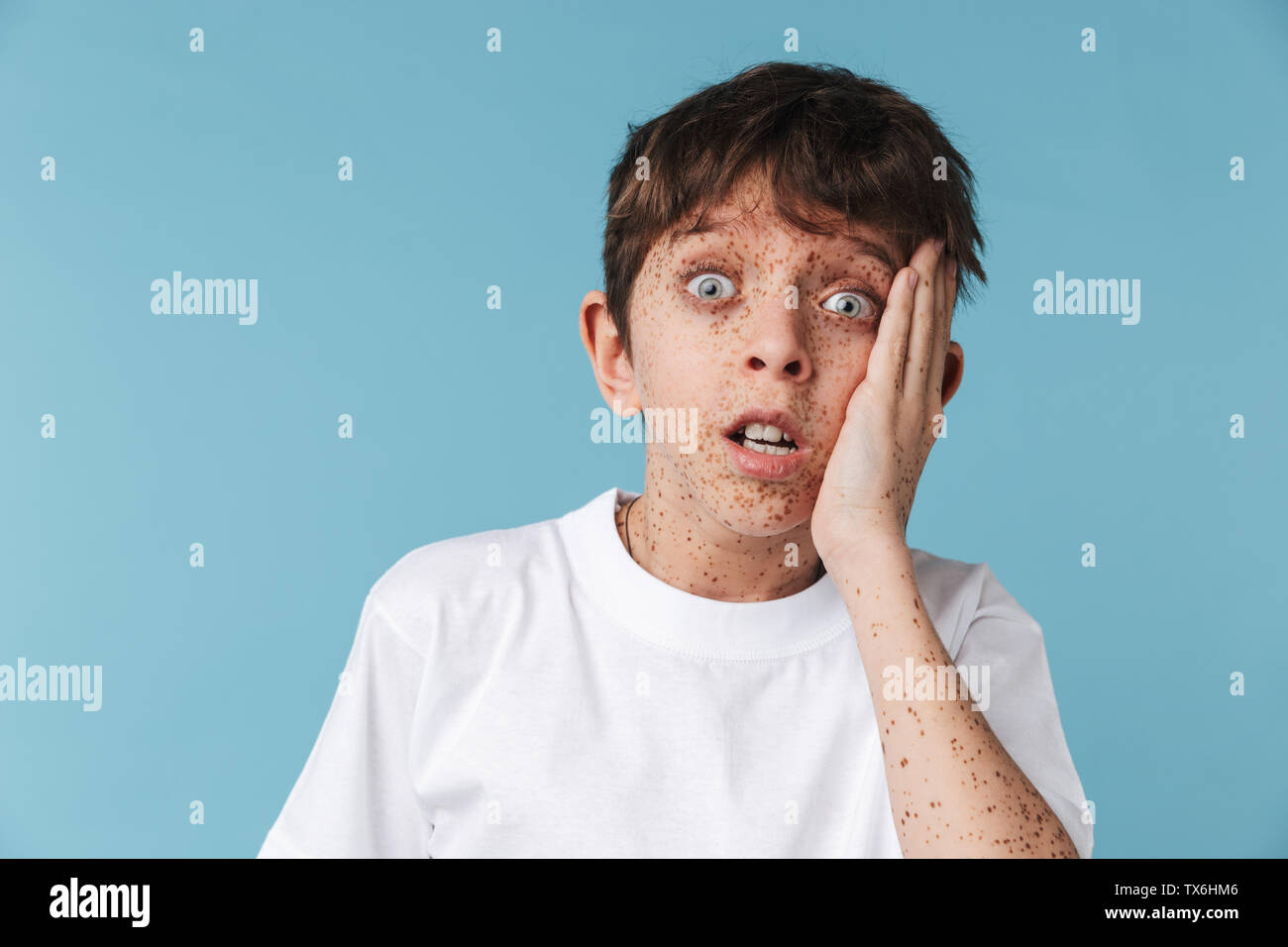 Portrait closeup of scared young boy 10-12y with freckles wearing white ...