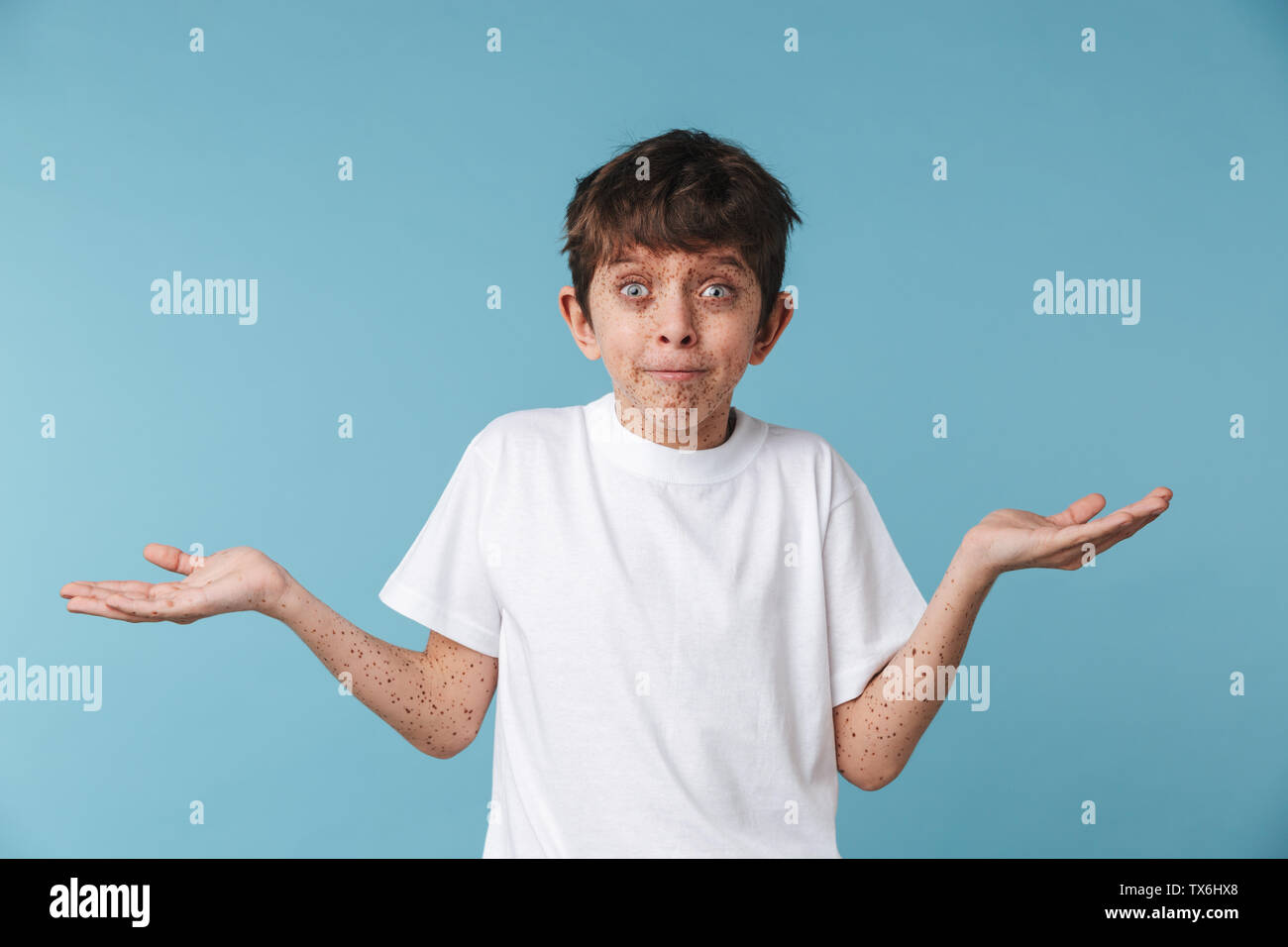 Portrait closeup of puzzled beautiful boy 10-12y with freckles wearing ...
