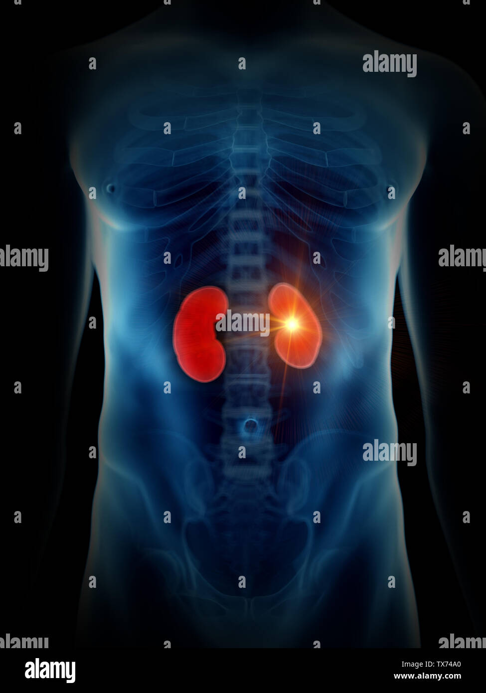 3d rendered medically accurate illustration of a painful kidney Stock ...