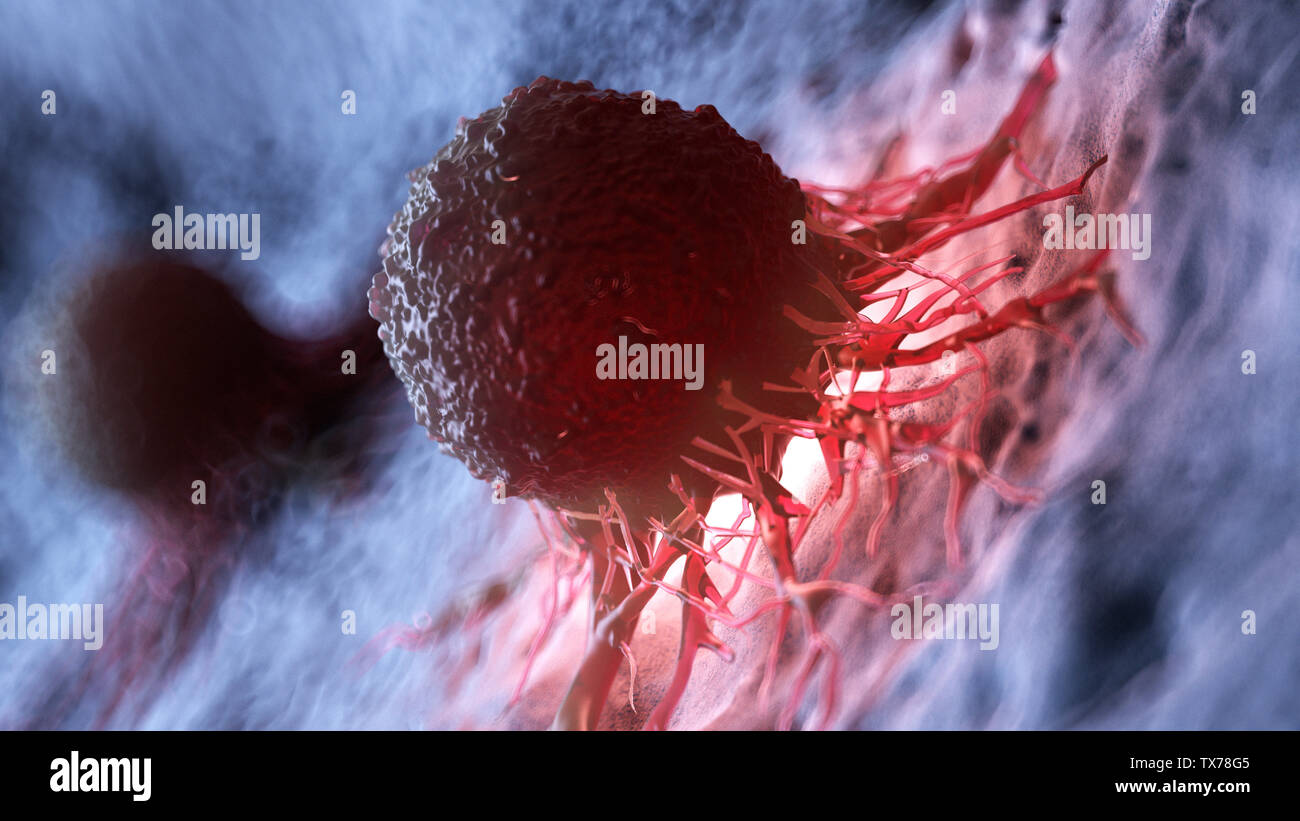 3d rendered illustration of a human cancer cell Stock Photo - Alamy
