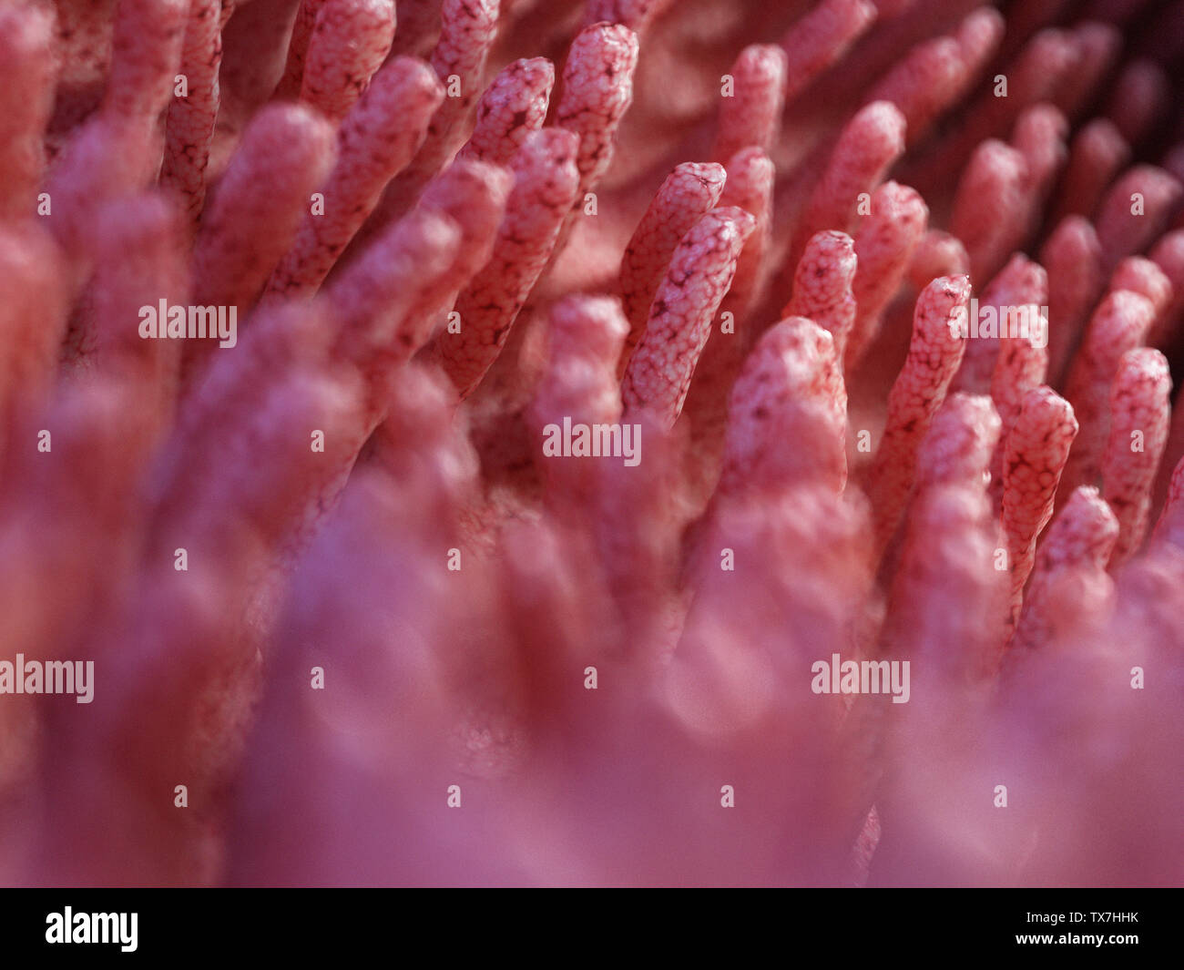 Inflamed bowel disease hi-res stock photography and images - Alamy