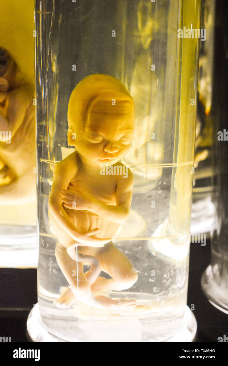 Formalin fetus hi-res stock photography and images - Alamy