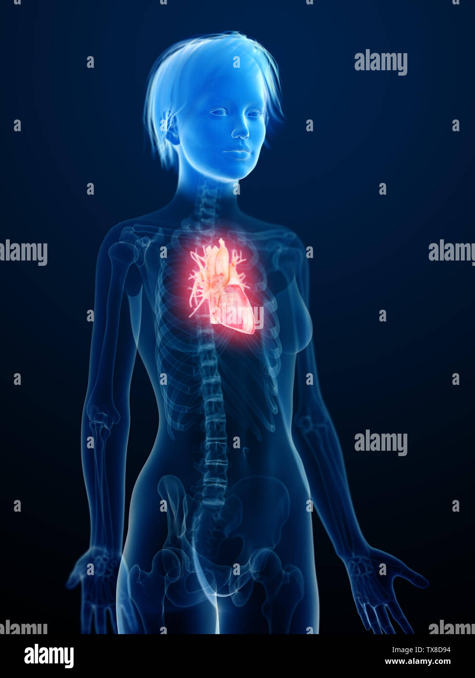 3d rendered medically accurate illustration of an inflamed heart Stock ...