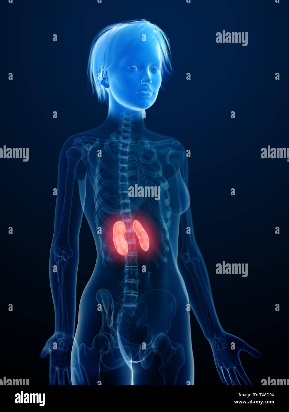 3d rendered medically accurate illustration of an inflamed kidneys ...