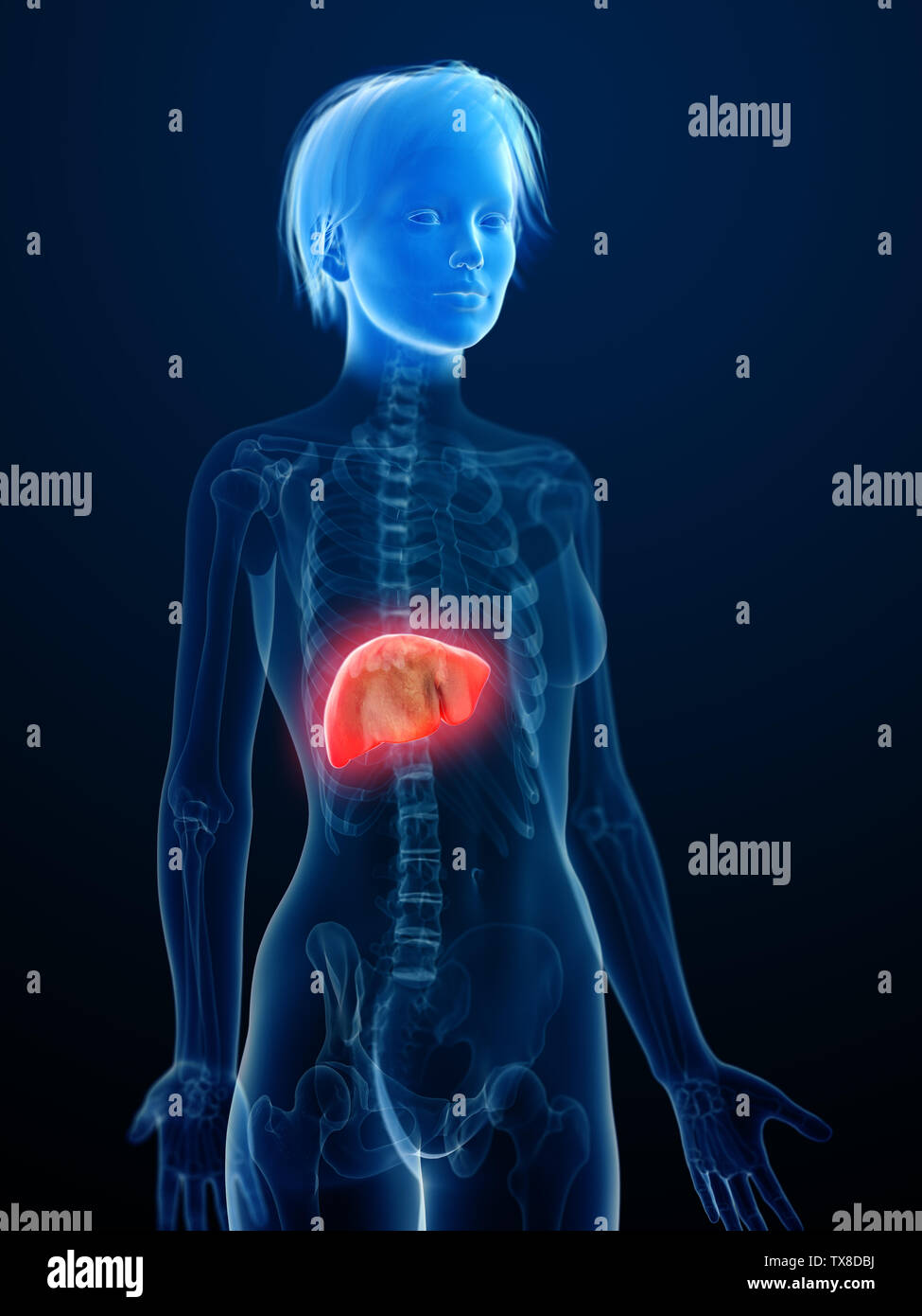 3d rendered medically accurate illustration of an inflamed liver Stock ...