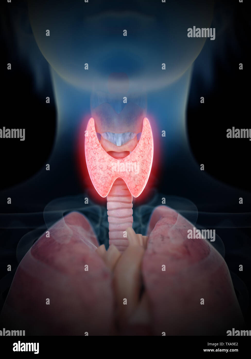 Inflamed thyroid hi-res stock photography and images - Alamy