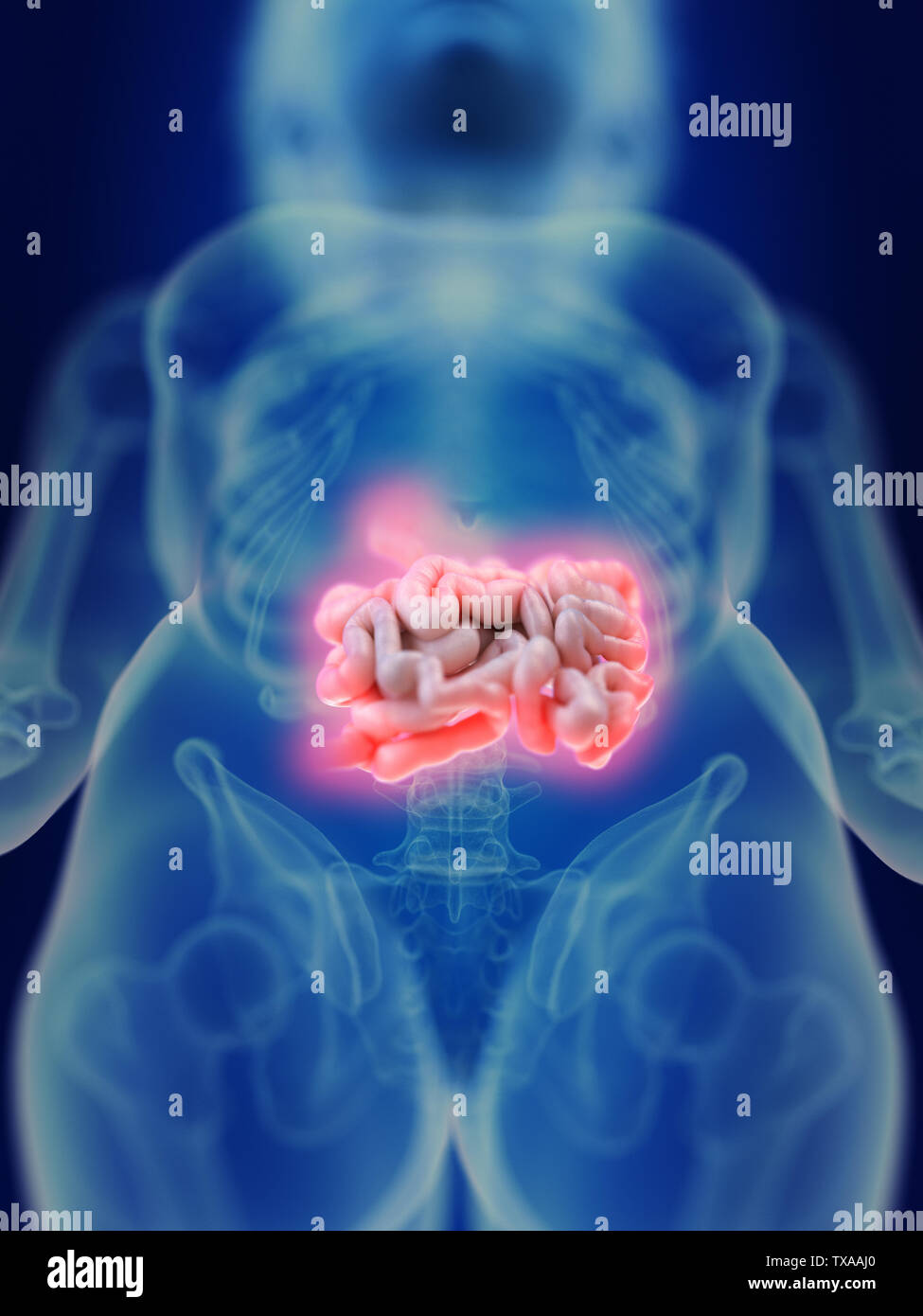 Intestine injury hi-res stock photography and images - Alamy