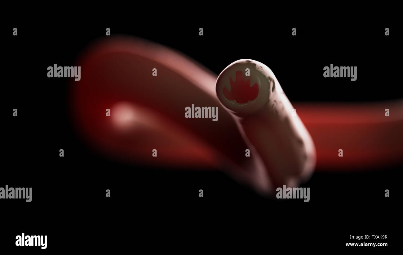 3d rendered medically accurate illustration of a hookworm Stock Photo ...