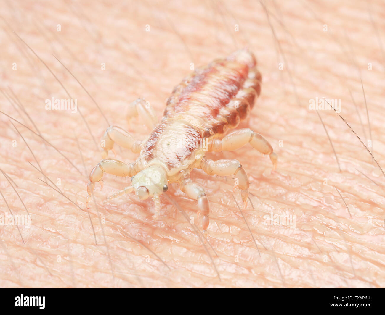 3d rendered medically accurate illustration of a head louse on human ...
