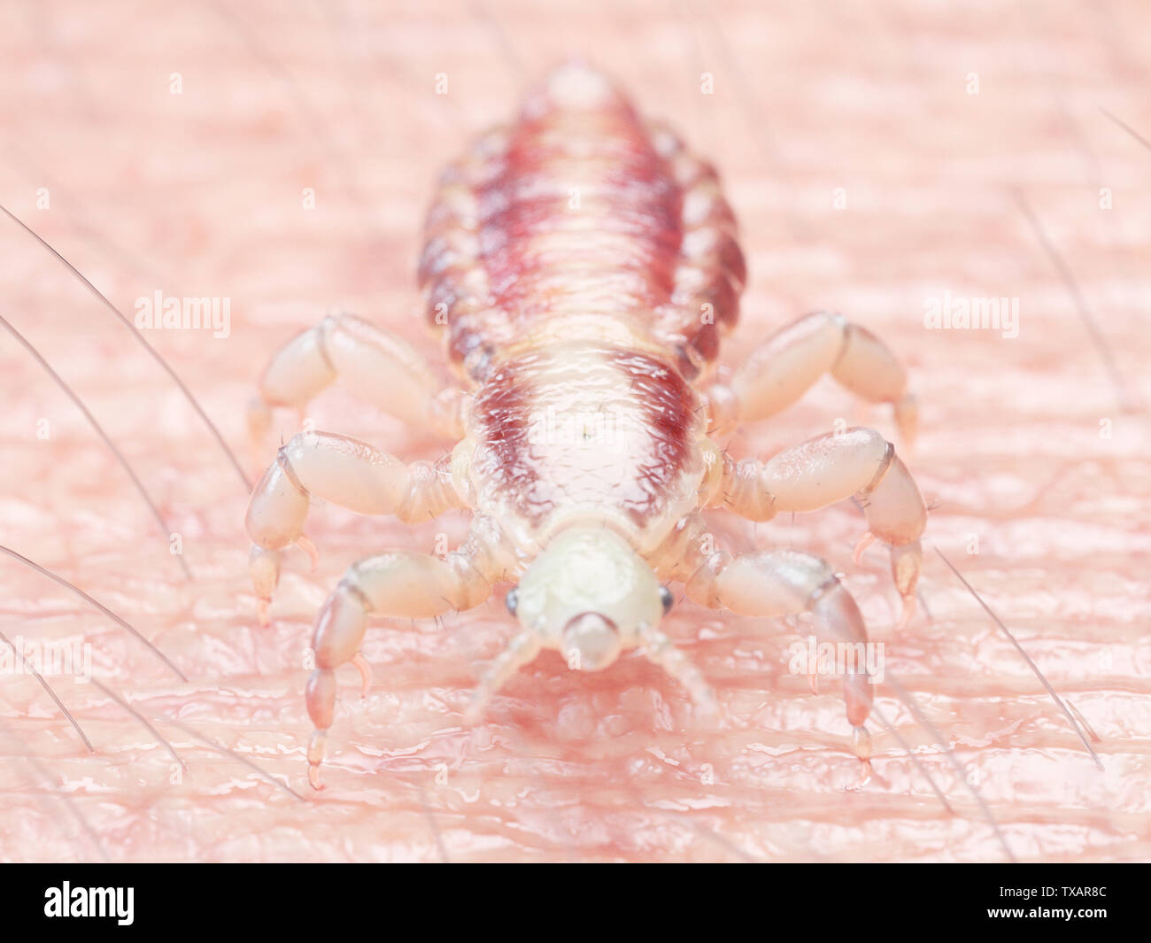 3d rendered medically accurate illustration of a head louse on human ...