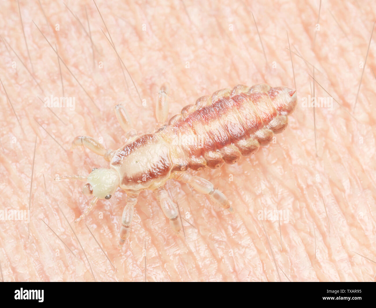 3d rendered medically accurate illustration of a head louse on human ...