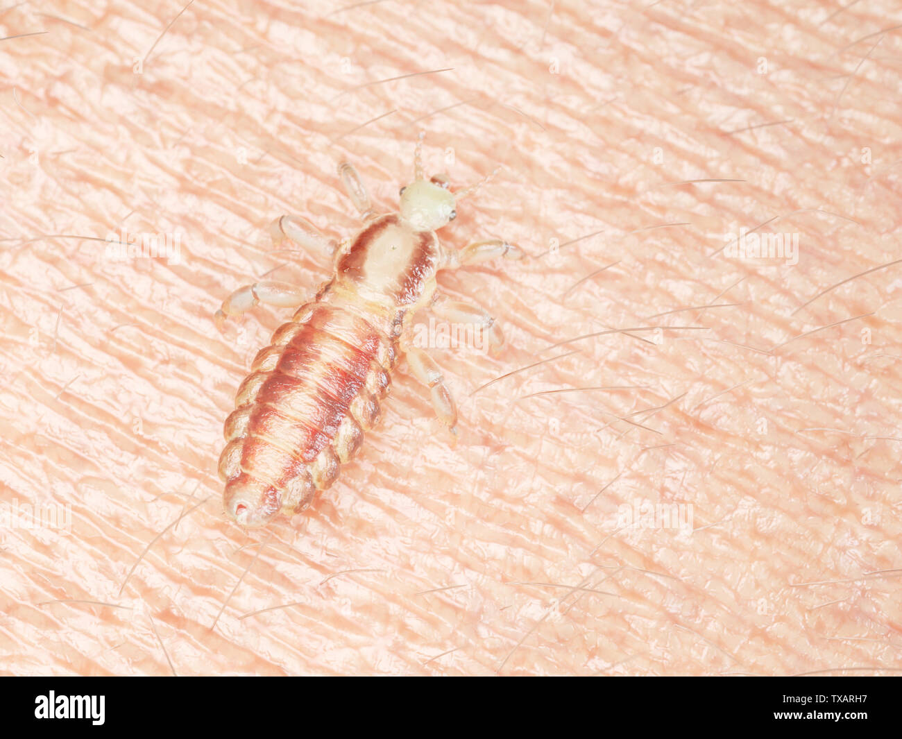 3d rendered medically accurate illustration of a head louse on human ...