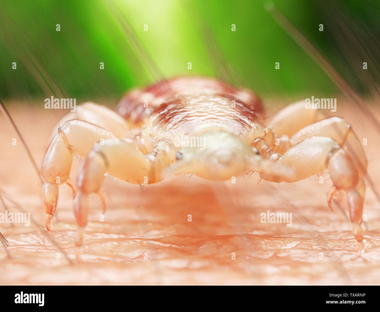 3d rendered medically accurate illustration of a head louse on human ...