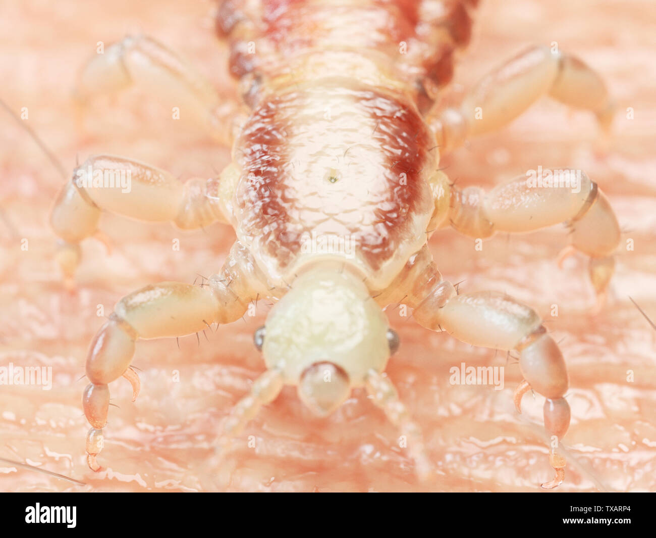 3d rendered medically accurate illustration of a head louse on human ...