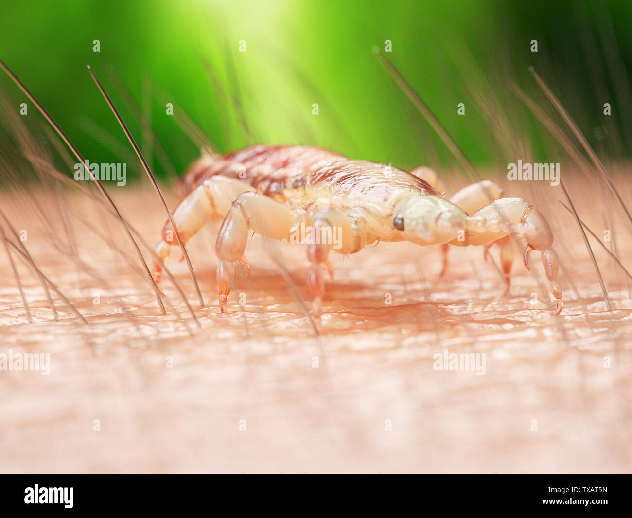 3d rendered medically accurate illustration of a head louse on human ...