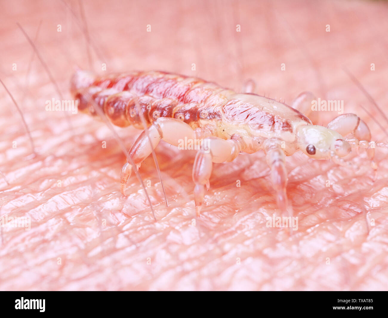 3d rendered illustration of a head louse on human skin Stock Photo - Alamy