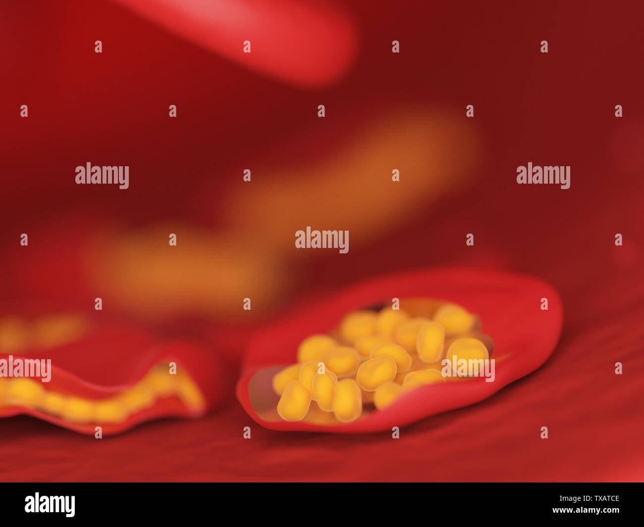 3d rendered illustration of malaria infected blood cells Stock Photo ...