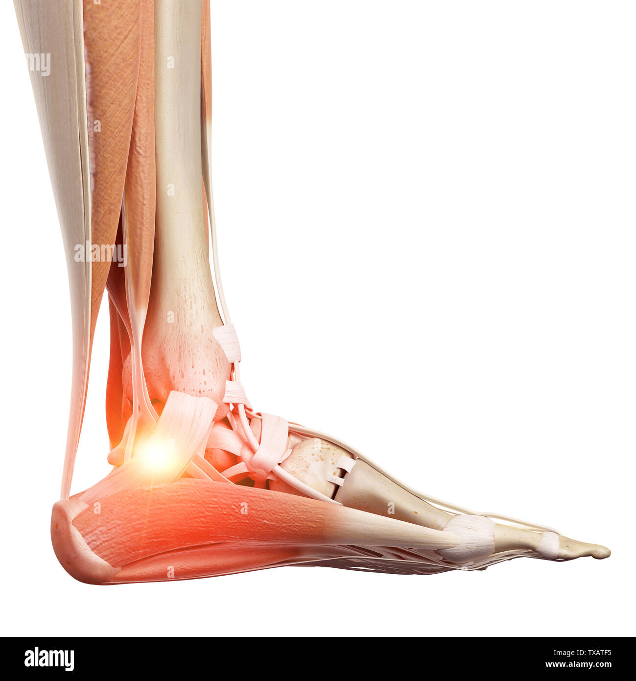 3d rendered medically accurate illustration of a painful ankle Stock ...