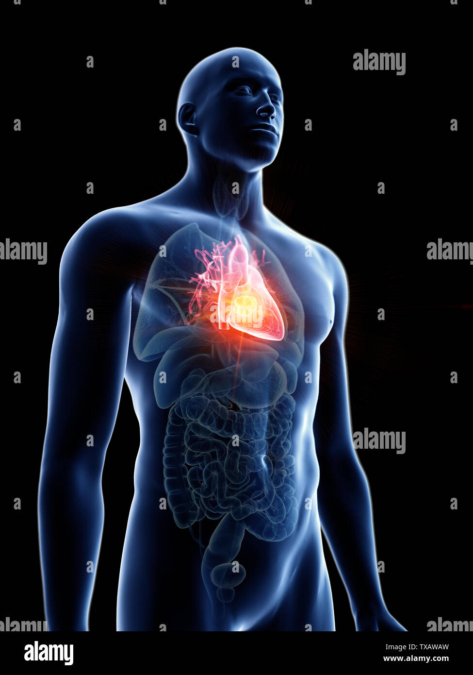3d rendered medically accurate illustration of a mans heart tumor Stock ...