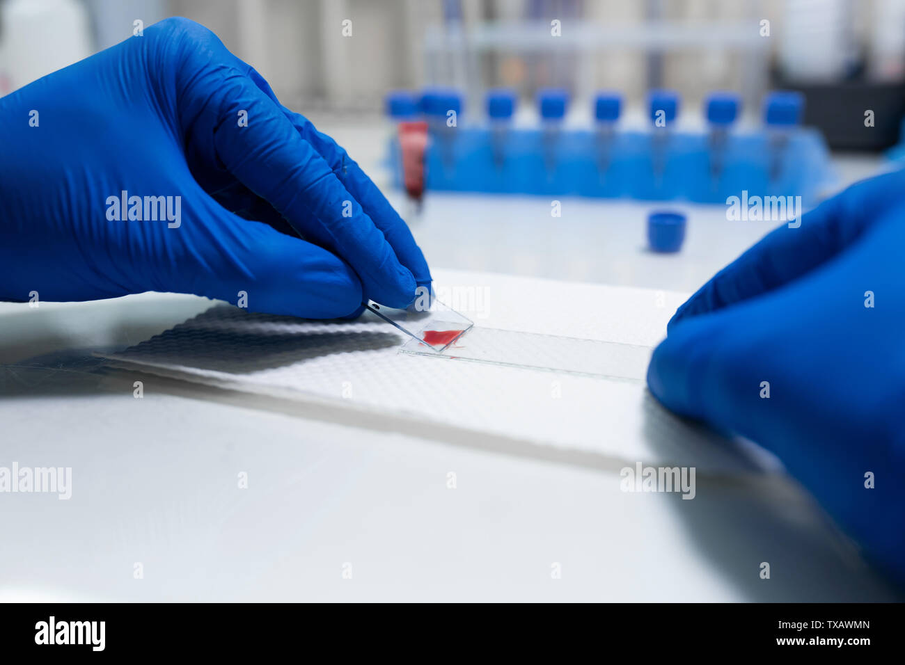 scientist prepare blood sample for research on microscope. Placing ...