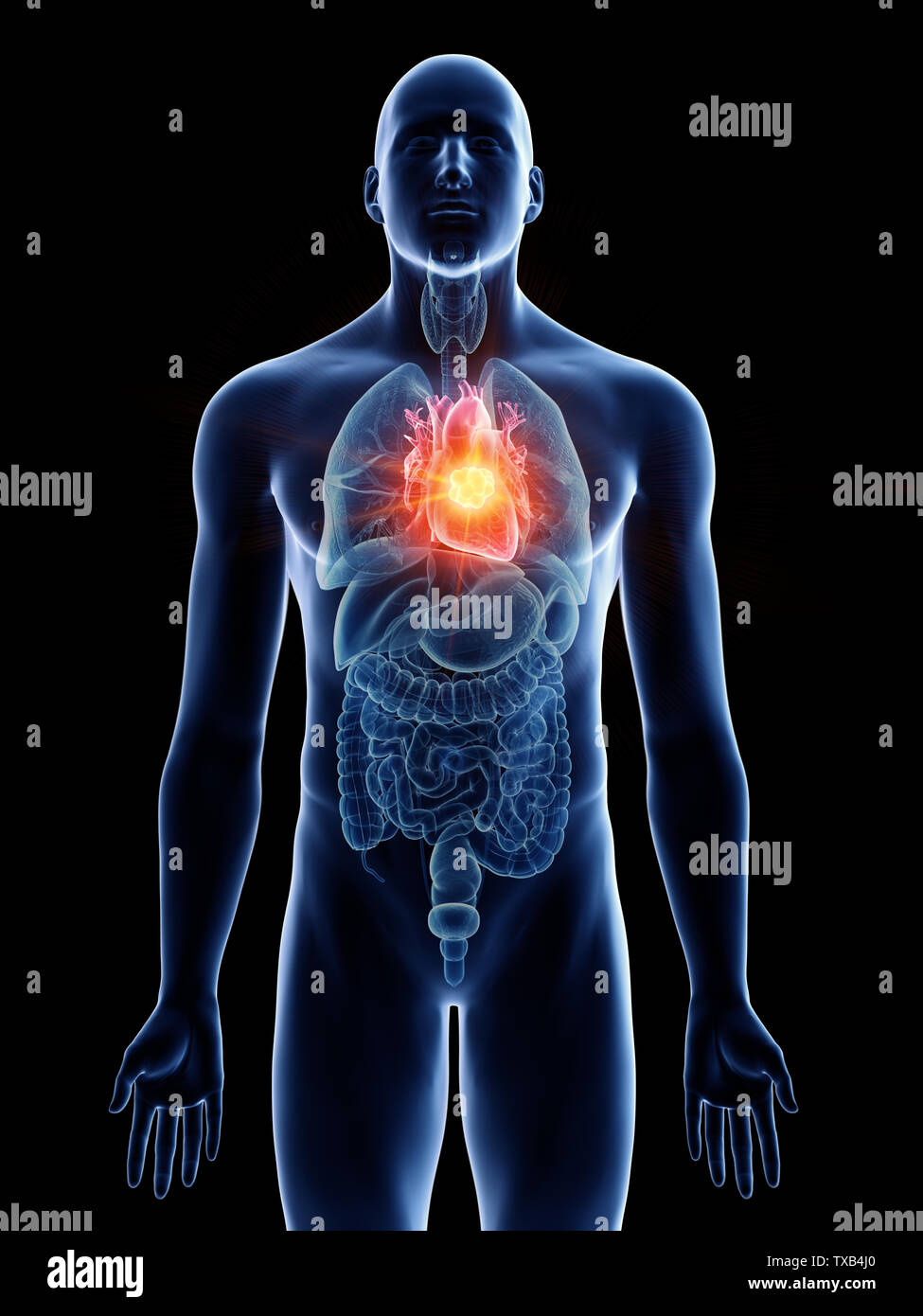 3d rendered medically accurate illustration of a mans heart tumor Stock ...