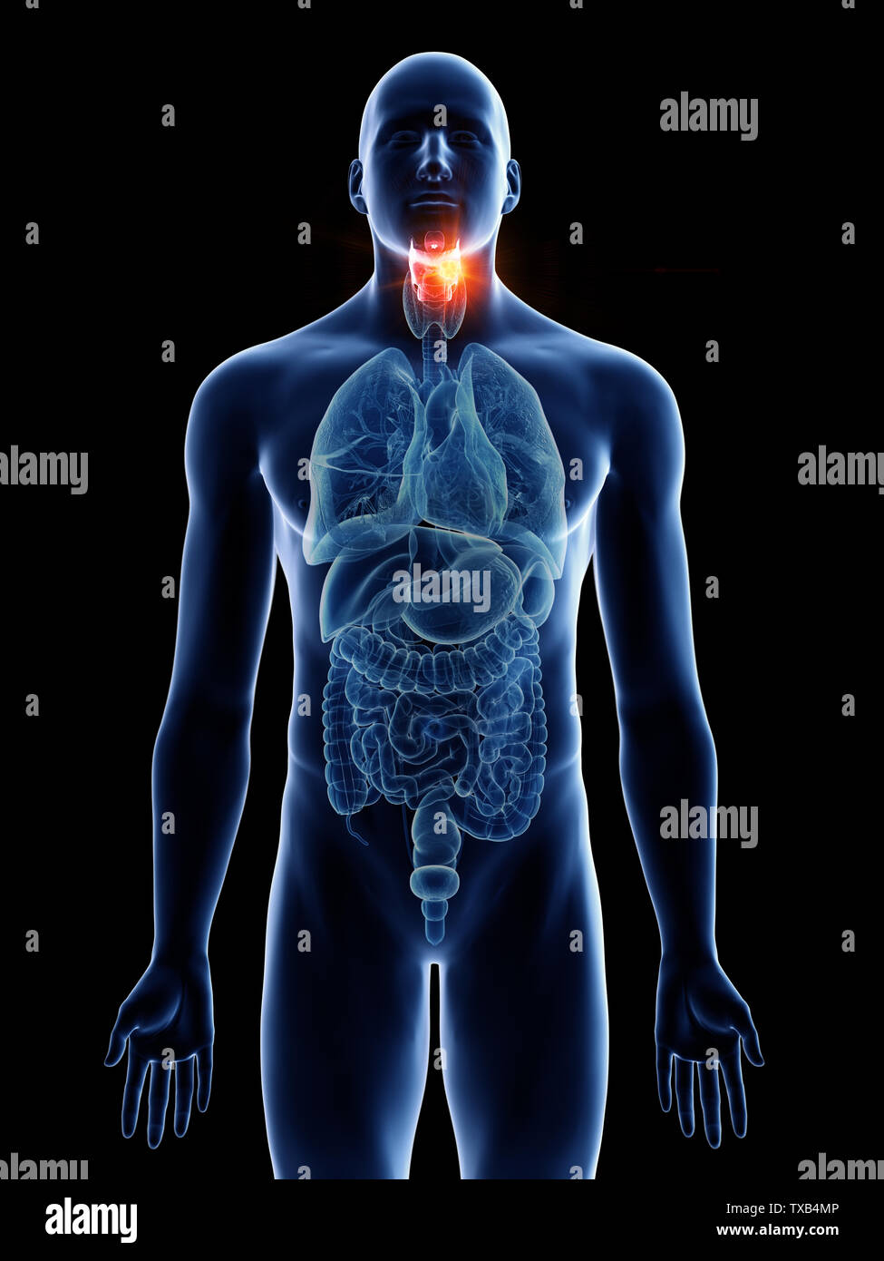 3d rendered medically accurate illustration of a mans larynx cancer ...