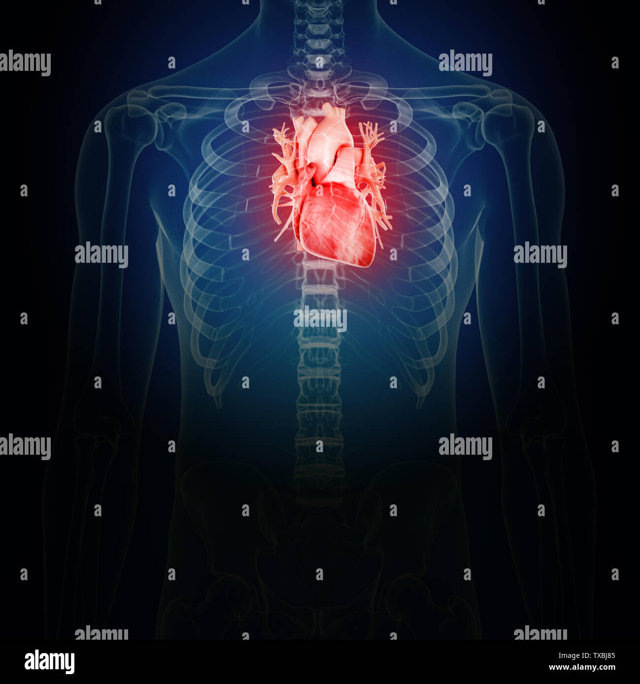 3d rendered medically accurate illustration of an inflamed heart Stock ...