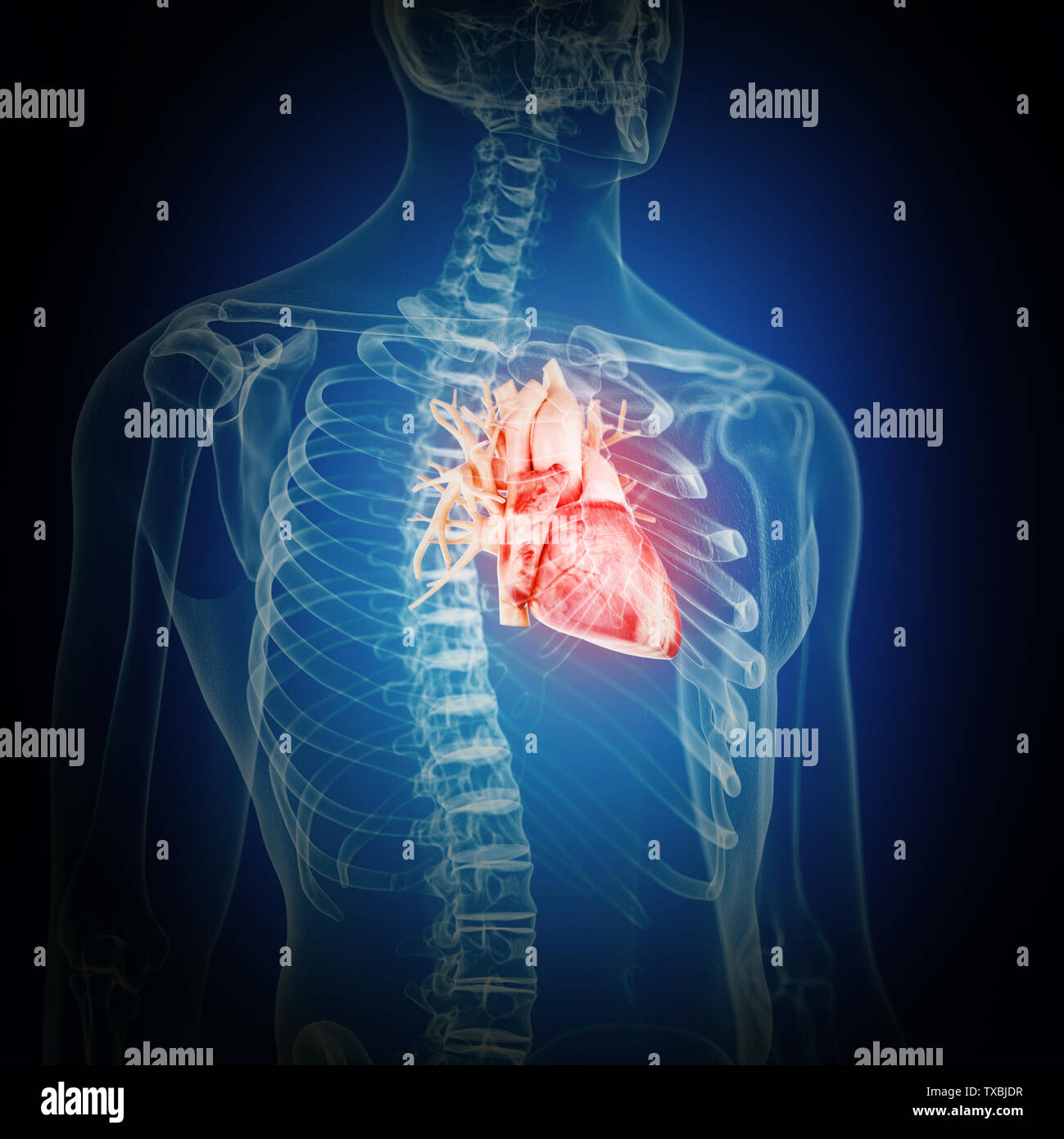 Inflamed heart hi-res stock photography and images - Alamy