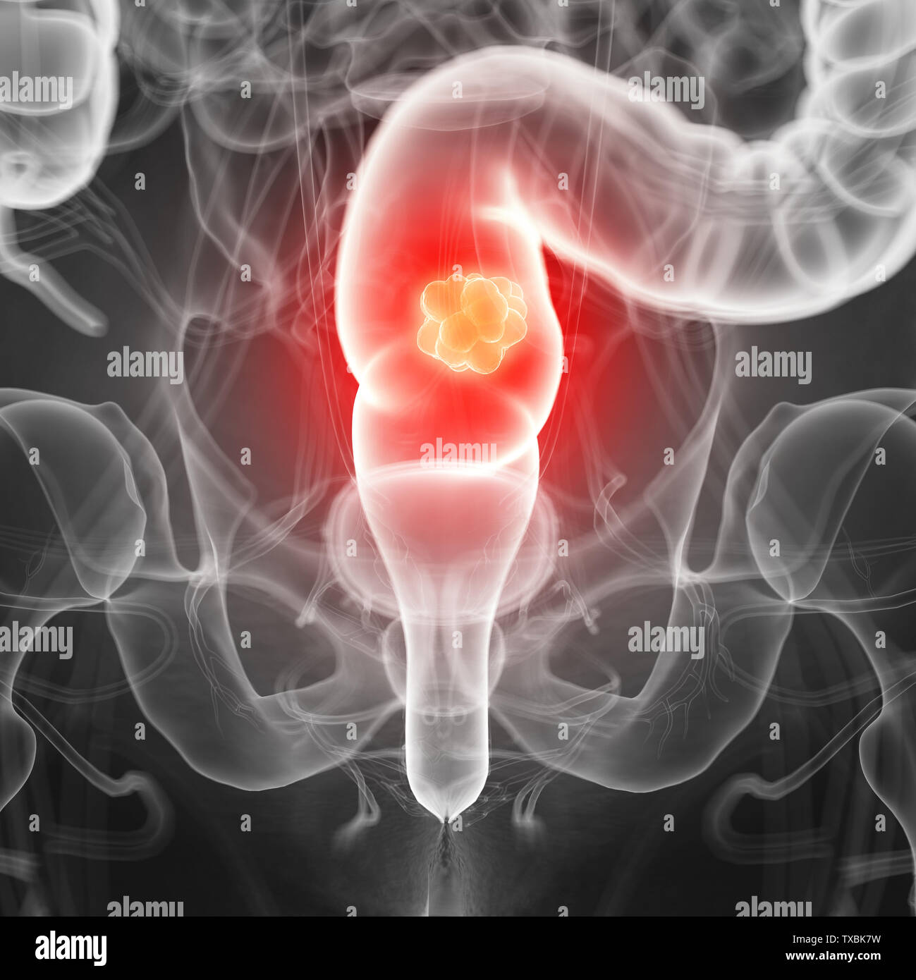 Rectal hi-res stock photography and images - Alamy