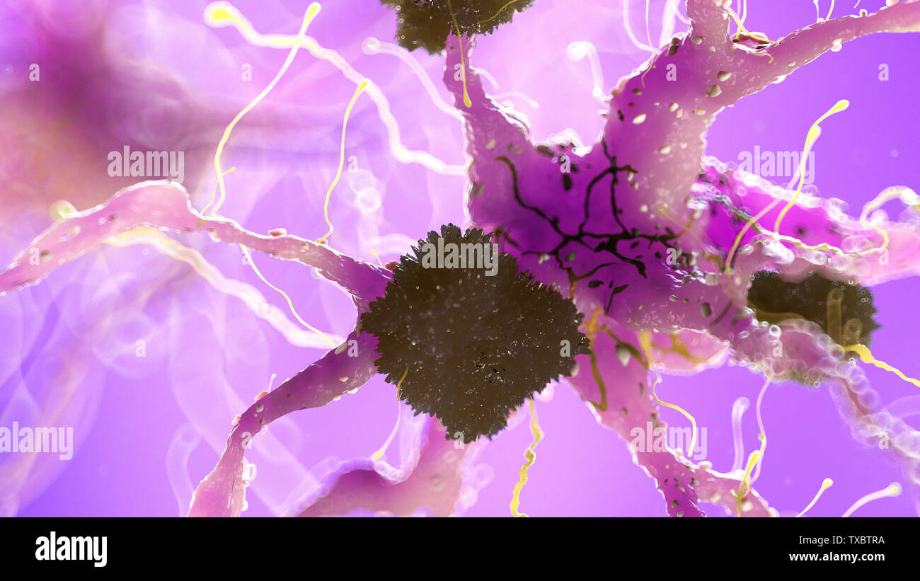 3d rendered medically accurate illustration of amyloid plaques on a ...