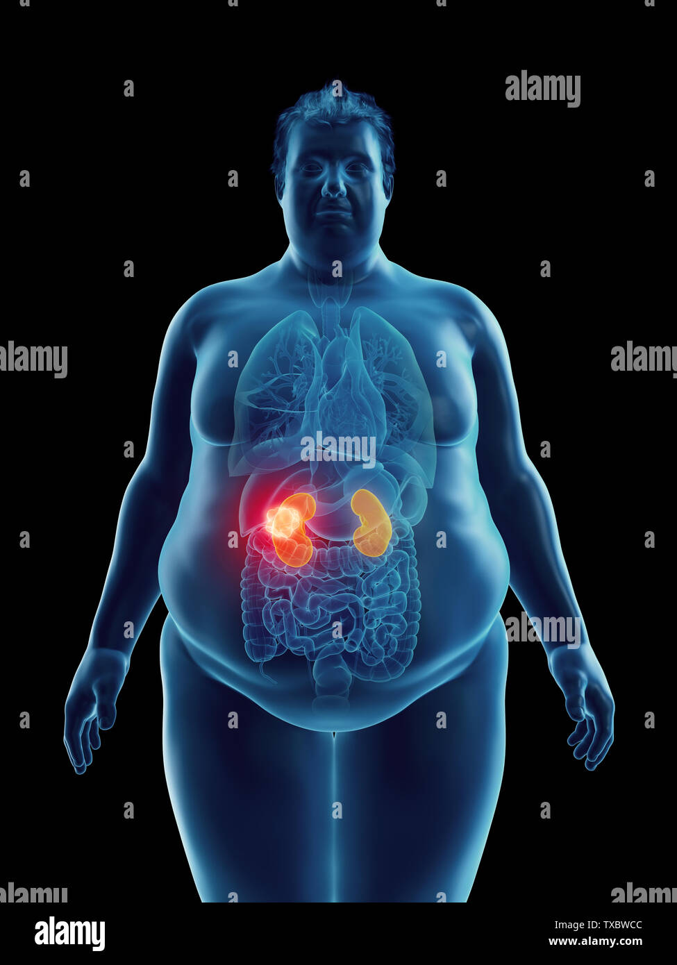 3d rendered medically accurate illustration of an obese mans kidney ...
