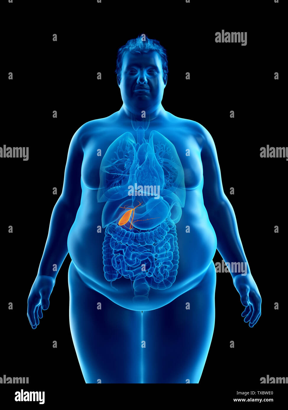 3d rendered medically accurate illustration of an obese mans ...