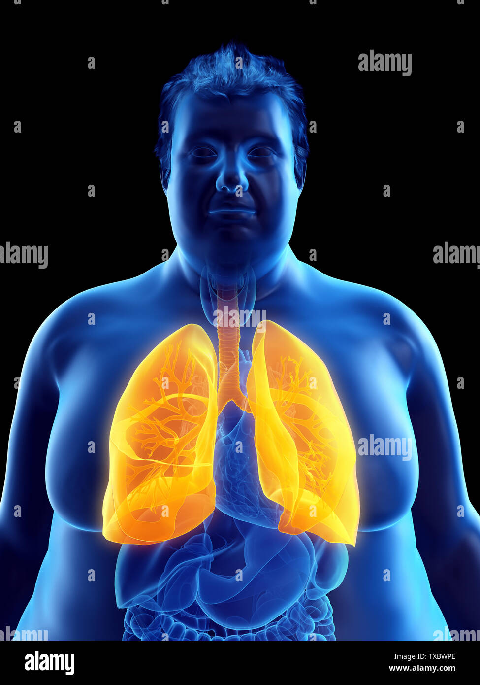 3d rendered medically accurate illustration of an obese mans lungs ...