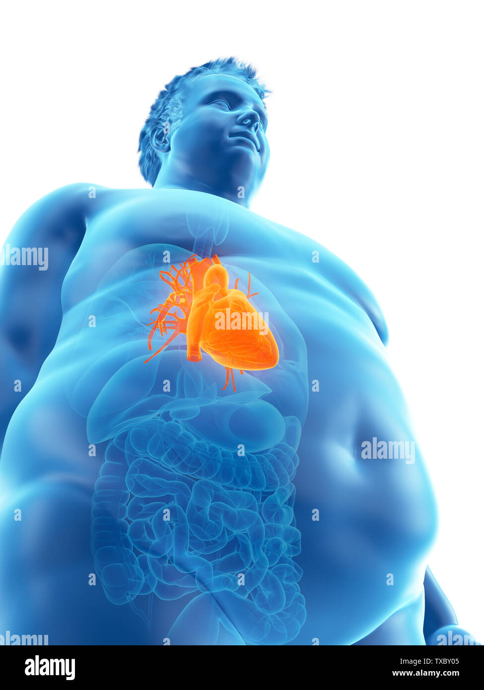 3d rendered medically accurate illustration of an obese mans heart ...