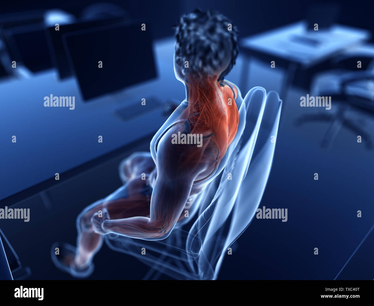 3d rendered illustration of a man working on a pc - painful muscles ...
