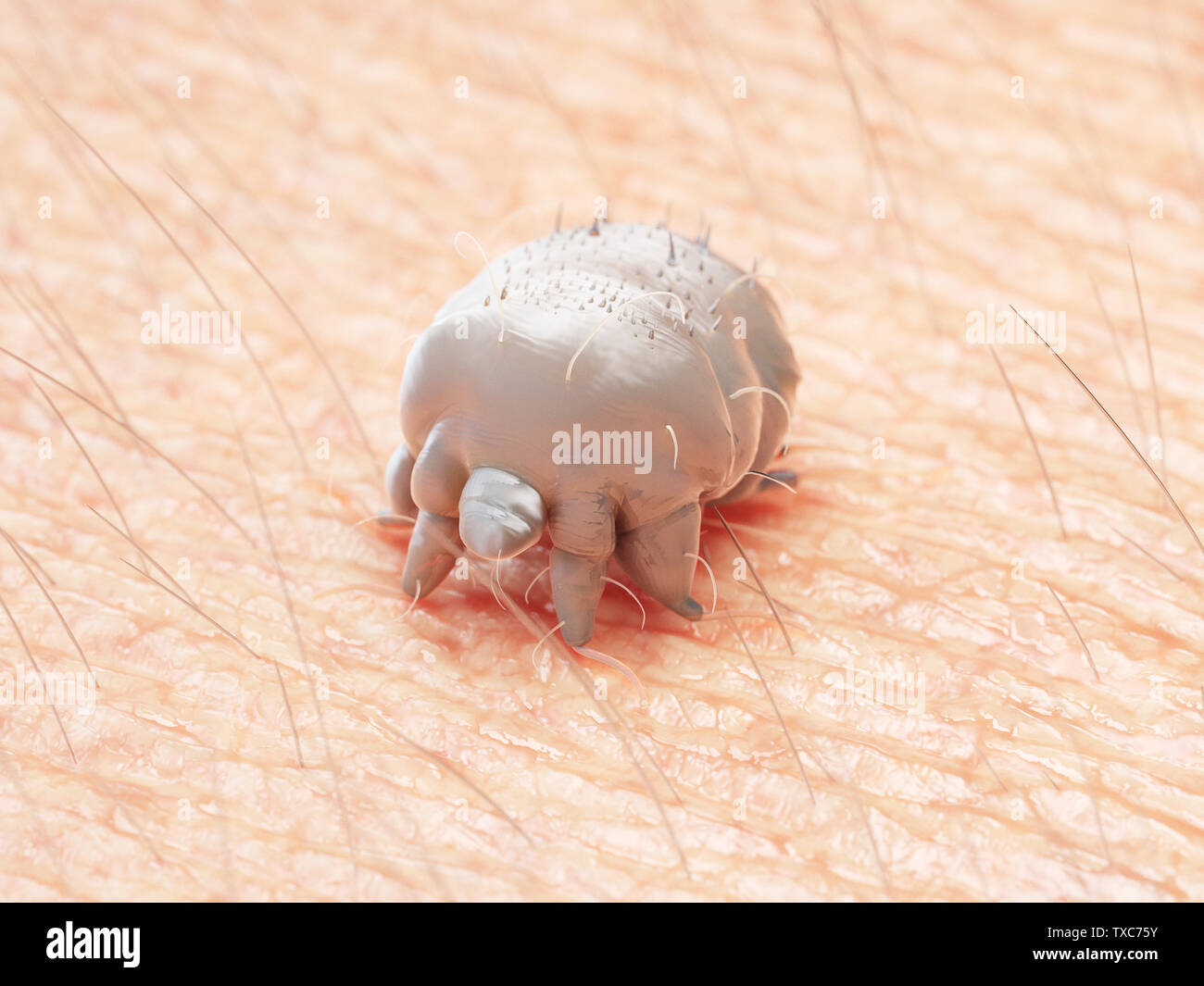Scabies Mite Size