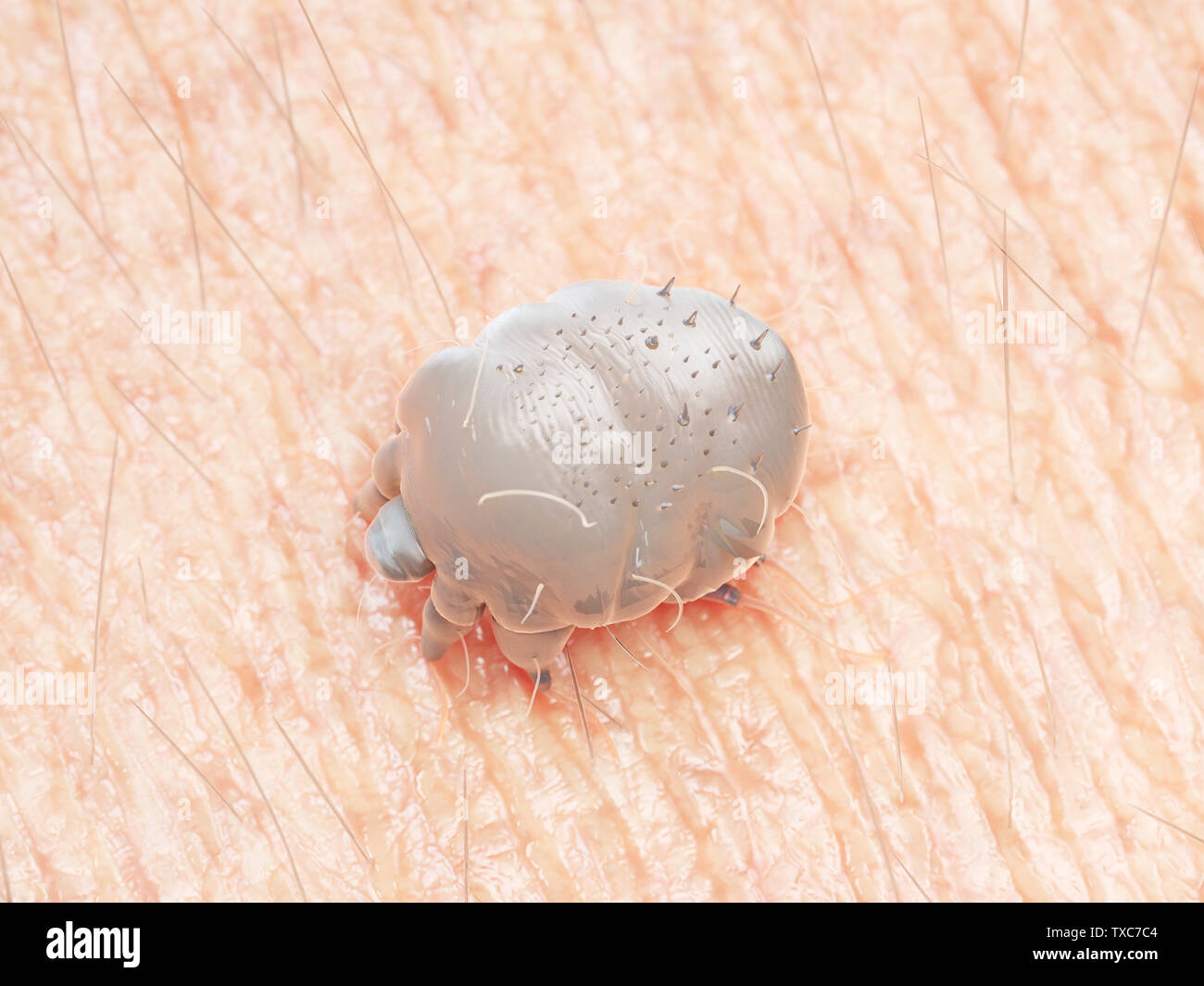 Scabies mites skin hi-res stock photography and images - Alamy