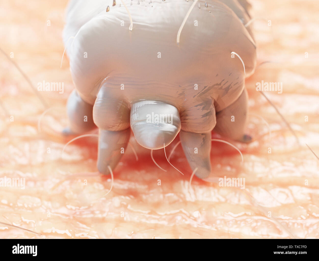 Human itch mite hi-res stock photography and images - Alamy