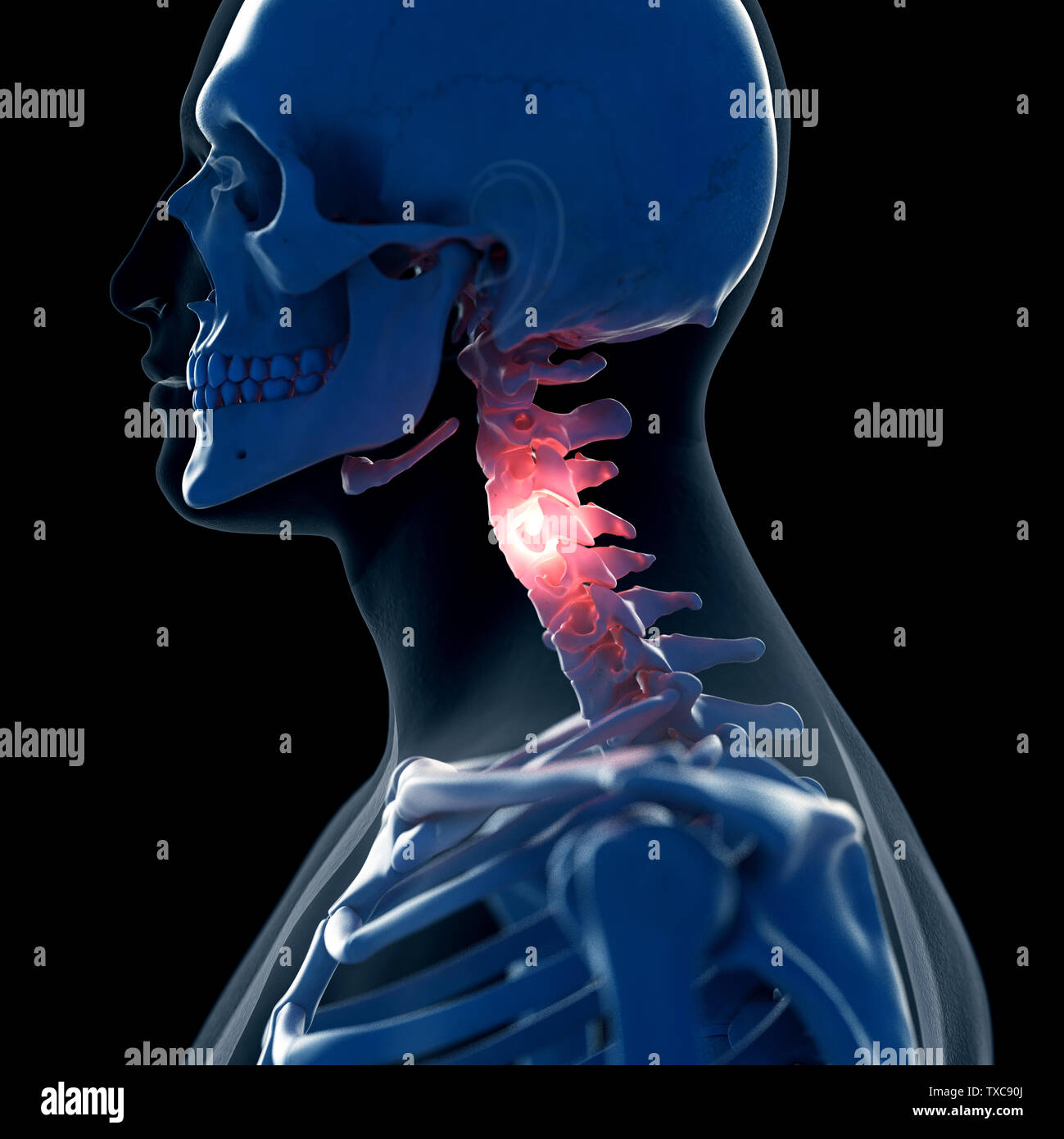 3d rendered medically accurate illustration of a painful neck Stock ...