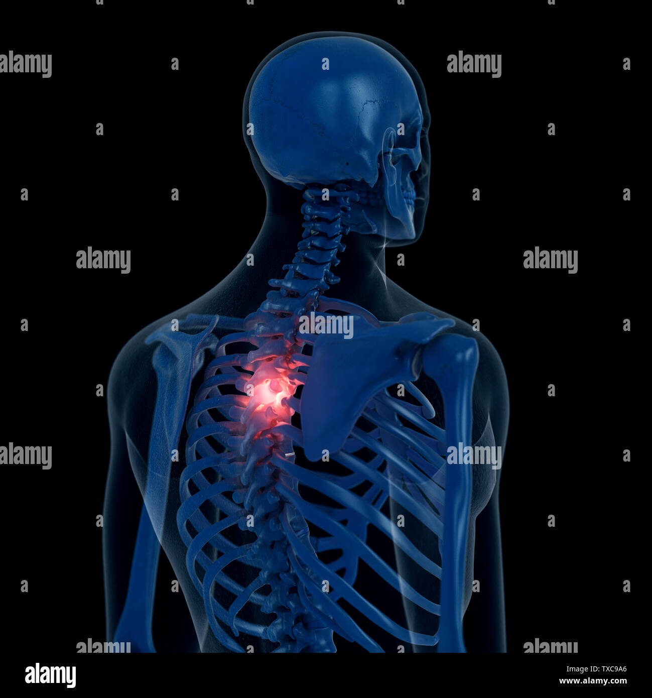 3d rendered medically accurate illustration of a painful thoracic spine ...