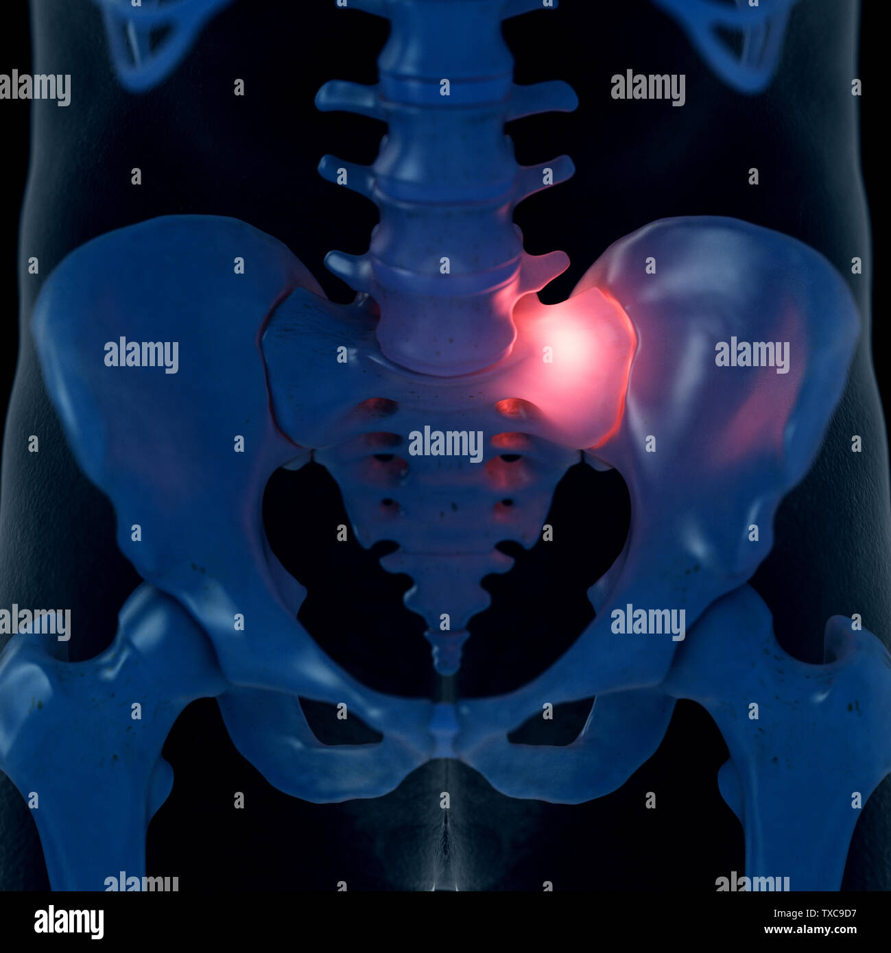 Sacroiliac Pain High Resolution Stock Photography and Images - Alamy