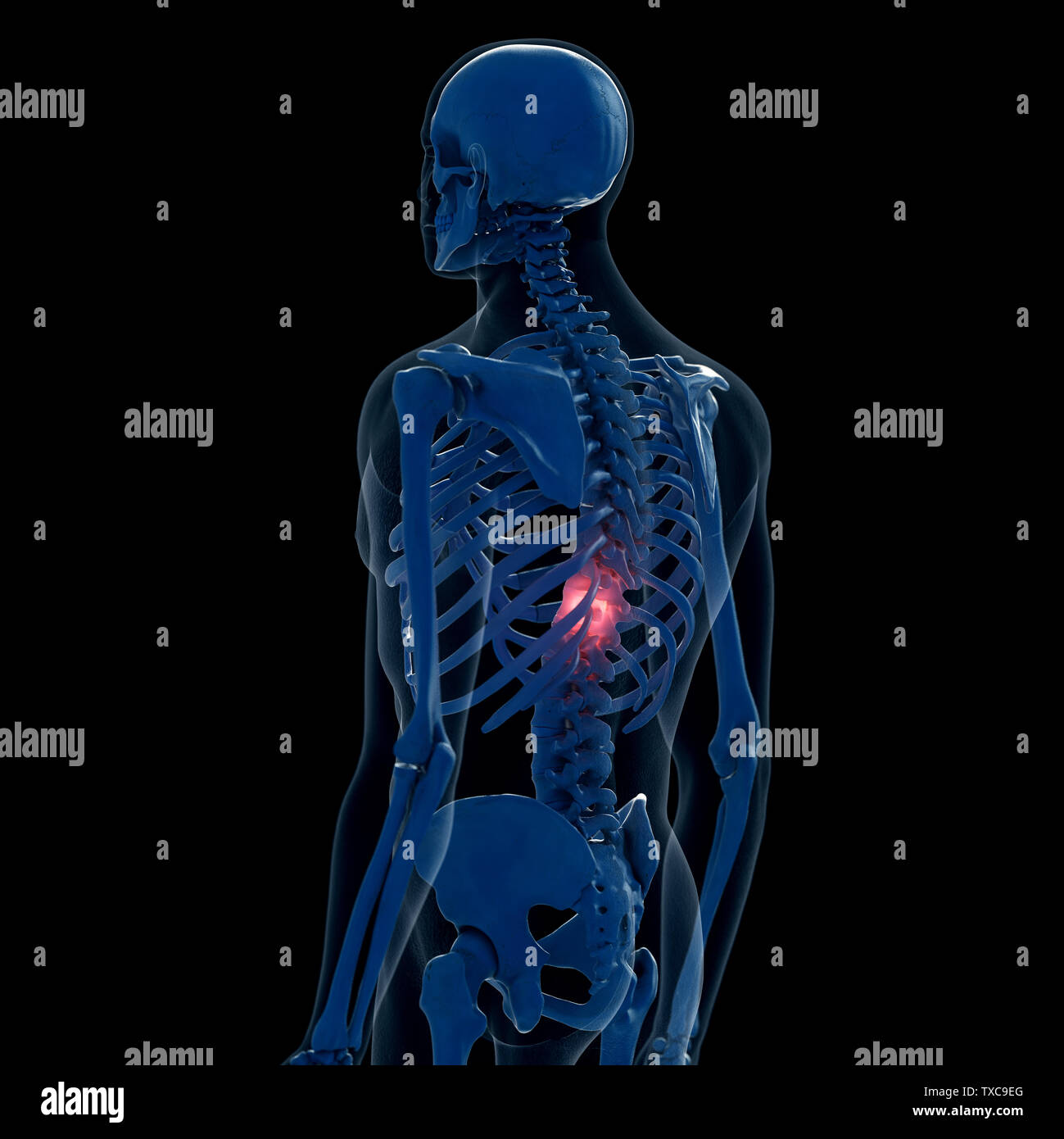 3d rendered medically accurate illustration of a painful back Stock ...