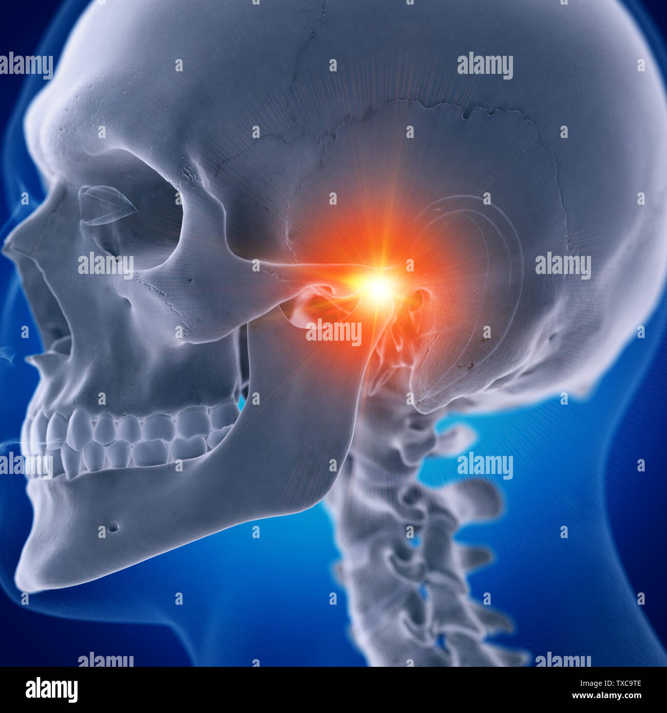 Temporomandibular hi-res stock photography and images - Alamy