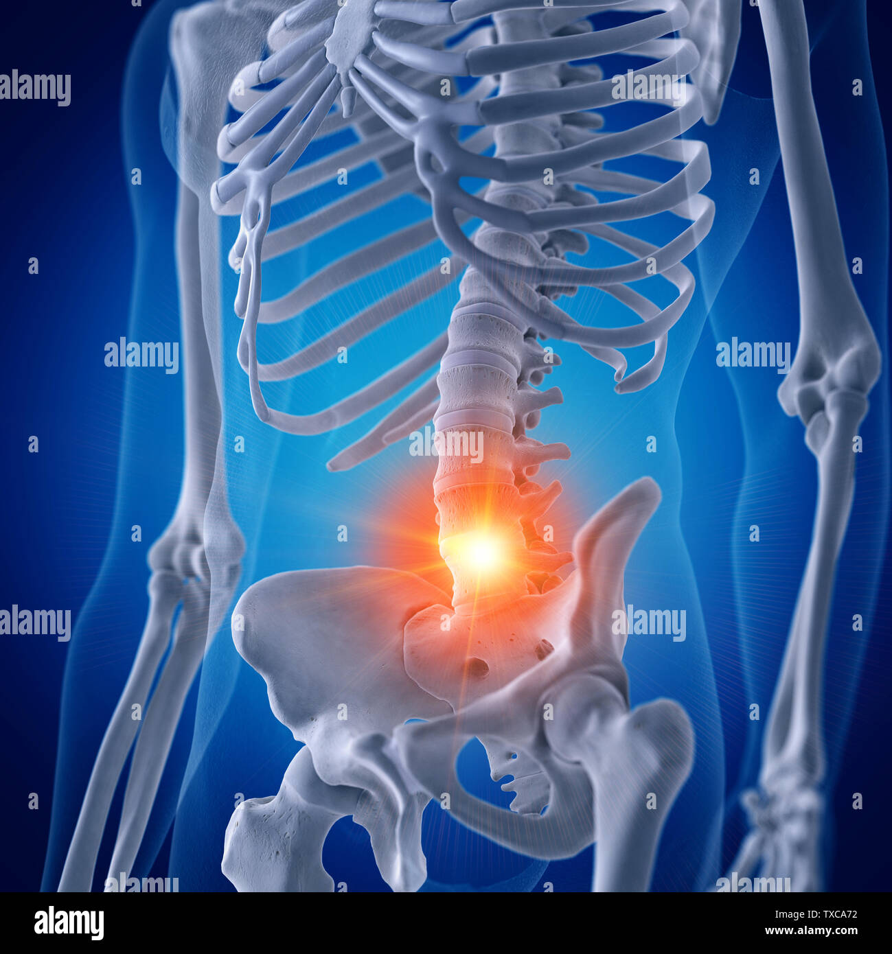 3d rendered medically accurate illustration of a painful lumbar spine ...