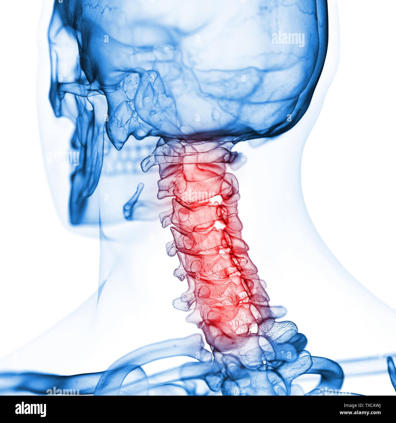 Cervical infection hi-res stock photography and images - Alamy